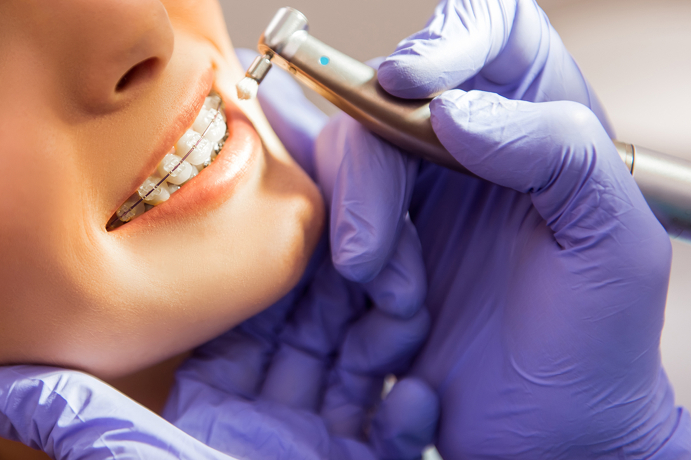 Can a wire be attached to a tooth that has had root canal treatment ...