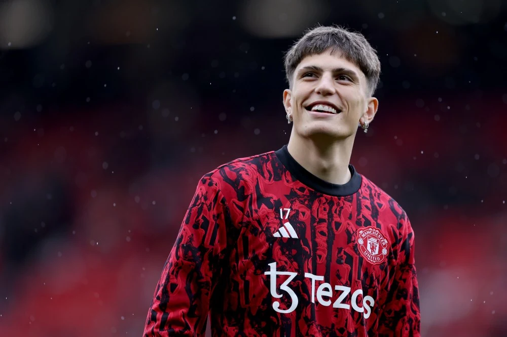 Alejandro Garnacho Teeth: Before and After | Dent X International