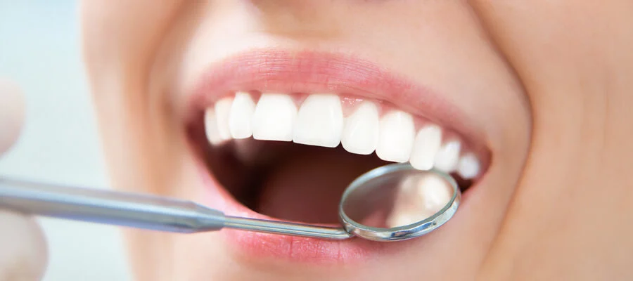 Notorious ‘Turkey Teeth’ – What You Need to Know Before Getting Your ...